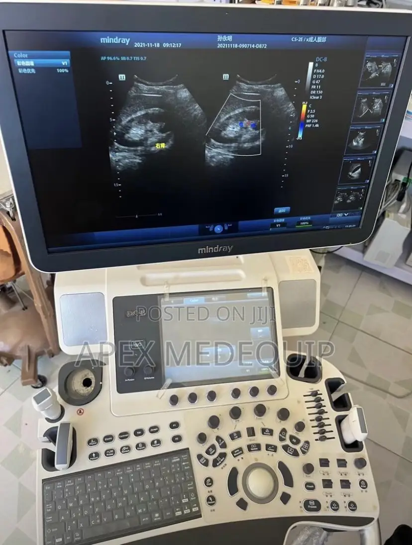 Mindray Dc-8 With 4 Probes in Accra Metropolitan - Medical Supplies & Equipment, Apex Medequip ...