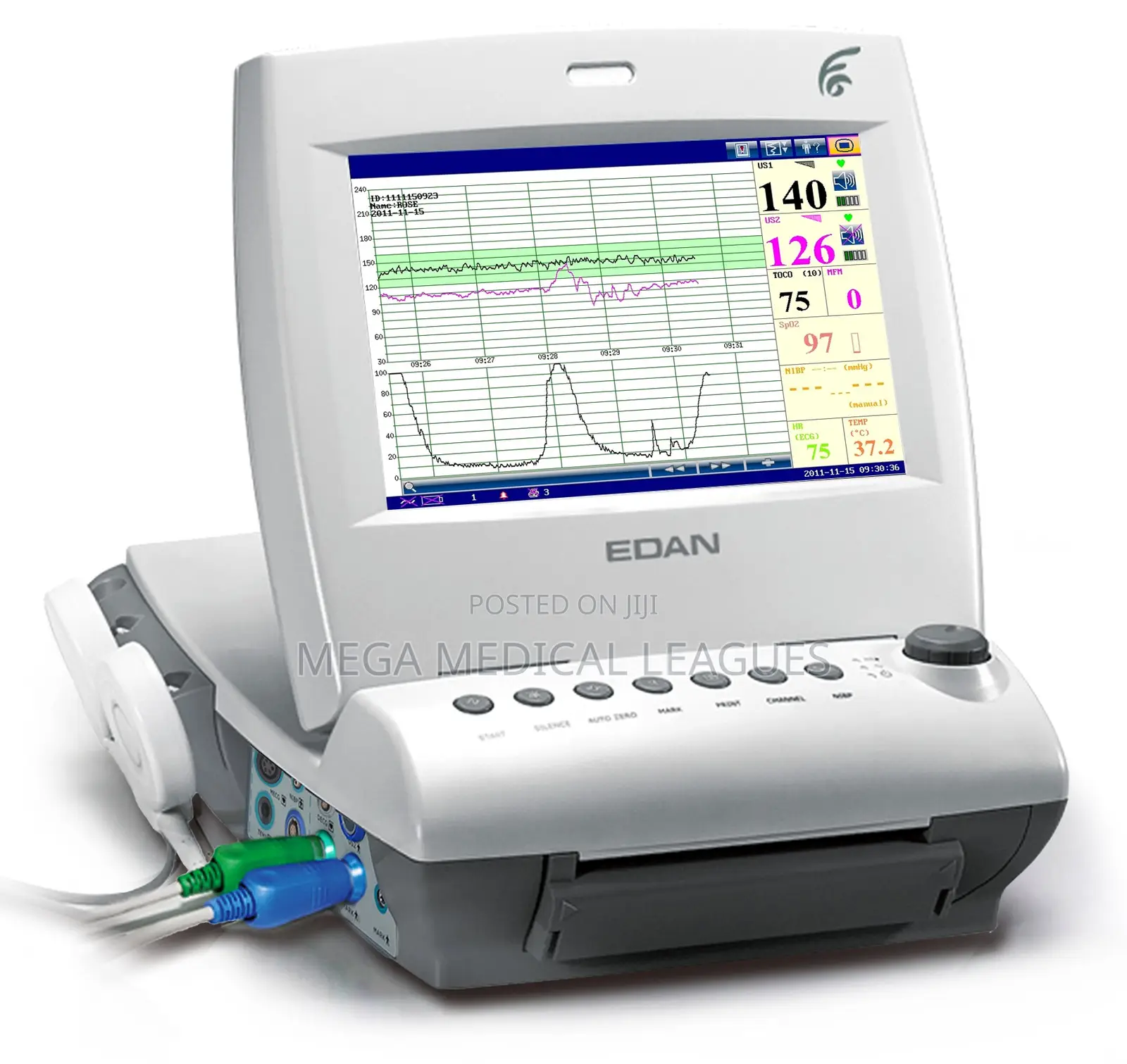 Edan F6E CTG Fetal Monitor in Osu - Medical Equipment & Supplies, Mml ...