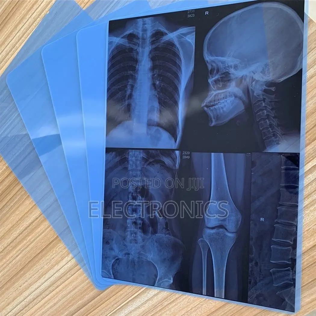 Medical X-Ray Film Blue in Accra Metropolitan - Medical Supplies ...