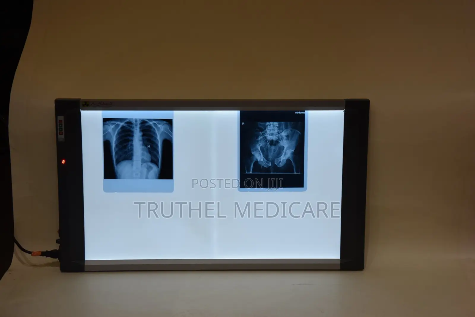 Xray Viewing Box - Single/Double in Accra Metropolitan - Medical ...