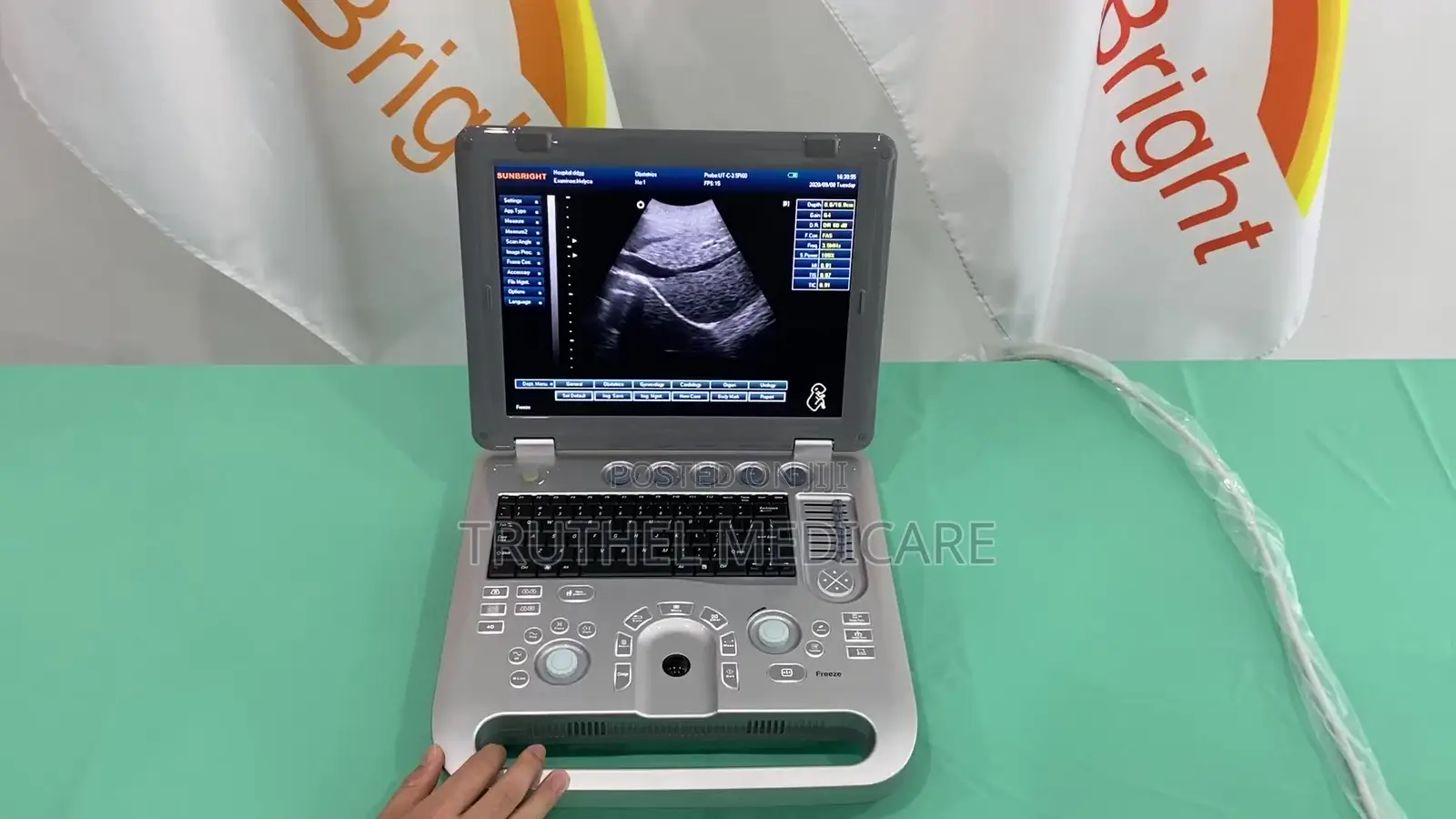 Portable Ultrasound Machine (Concex Probe) in Accra Metropolitan ...
