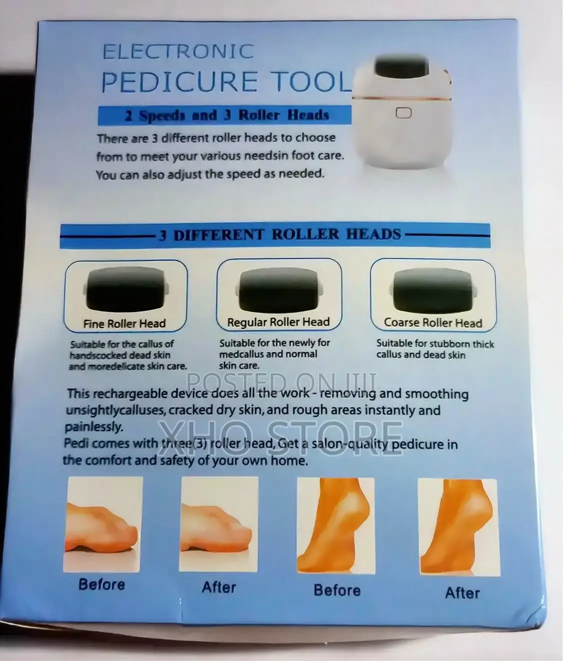 Usb Charged Foot Scrubber Set With 3 Replaceable Roller Heads-Pedicure ...