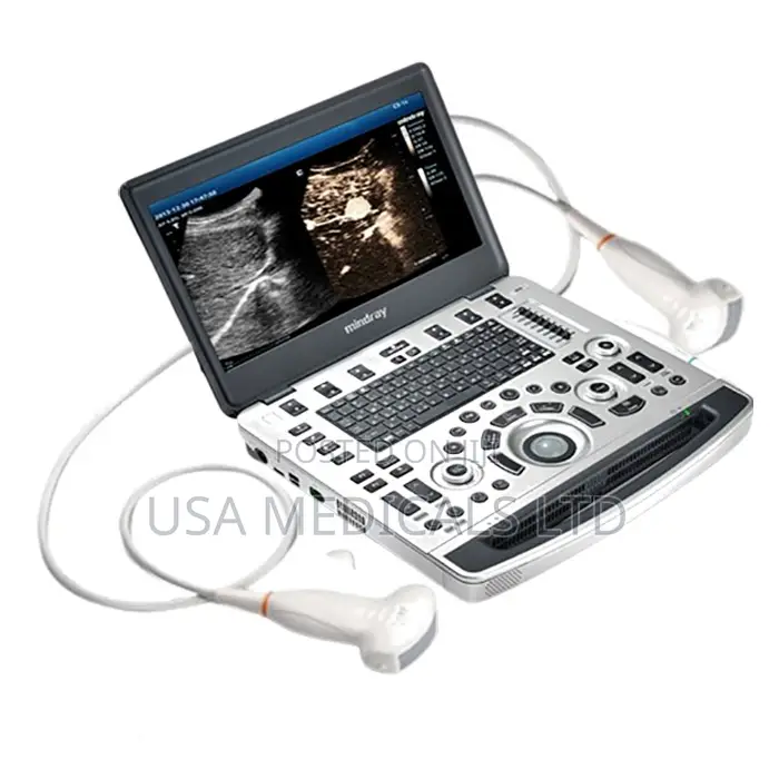 Mindray Dp 10 Ultrasound Scan Machine With Convex and Linear Probes in ...